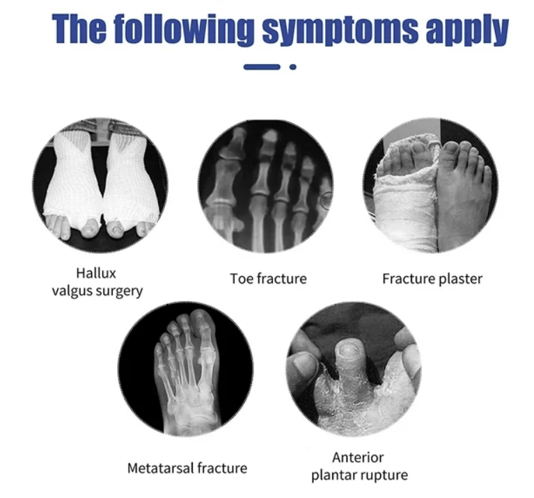 Toe Off-loading Shoe – Total Care